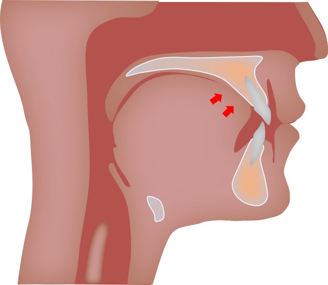 평상시 혀의 위치(Resting tongue posture)에 대해 : 네이버 블로그