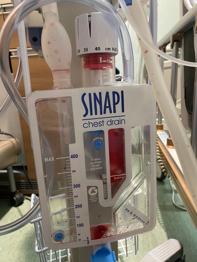 [Nursing] SINAPI Chest bottle 시나피 체스트 보틀 : 네이버 블로그