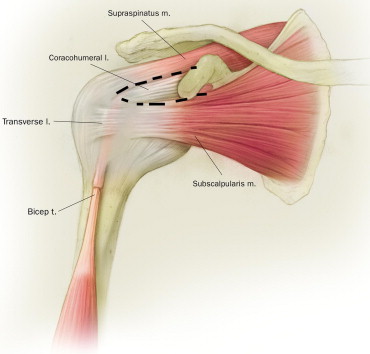 견갑대의 인대 -2 (Rotator Cuff Interval) : 네이버 블로그