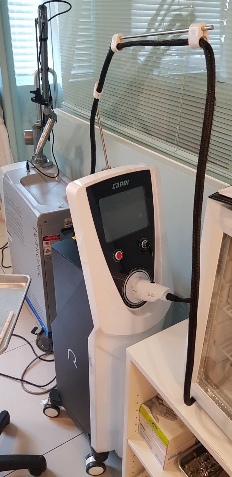 [판매보류] [중고] 카프리레이저, CAPRI LASER : 네이버 블로그