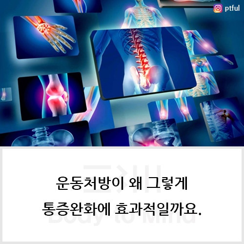 운동처방이 왜 그렇게 통증완화에 효과적일까요 네이버 블로그