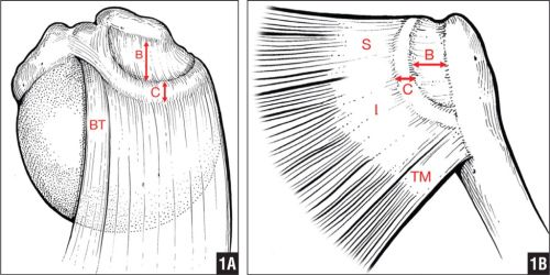 [어깨 관절] shoulder joint 4편_ rotator cable, 전거근, 신경 수용체 : 네이버 블로그