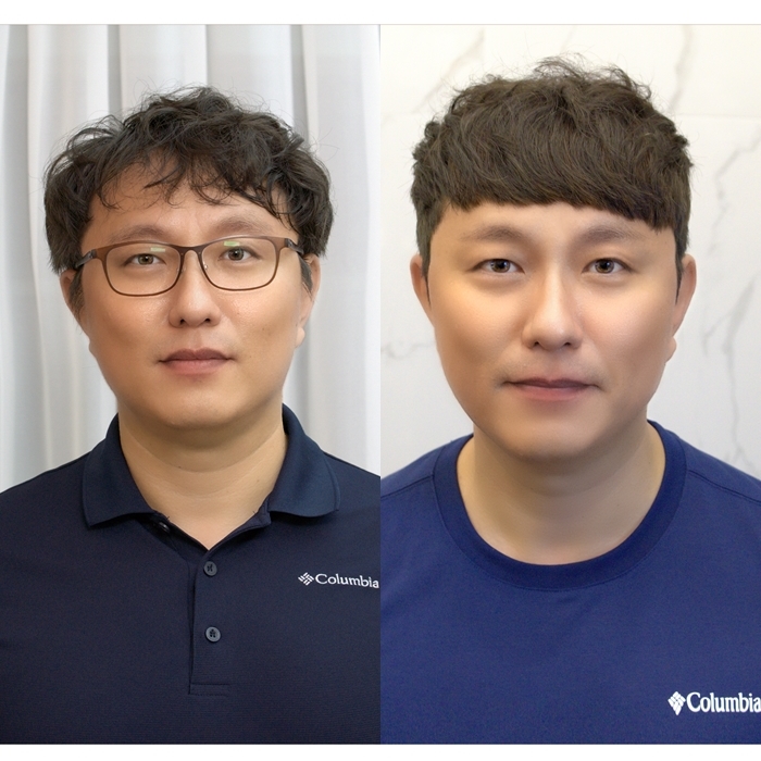 M자탈모 남자 앞머리 탈모 커버 M자머리 스타일에 댄디컷 네이버 블로그