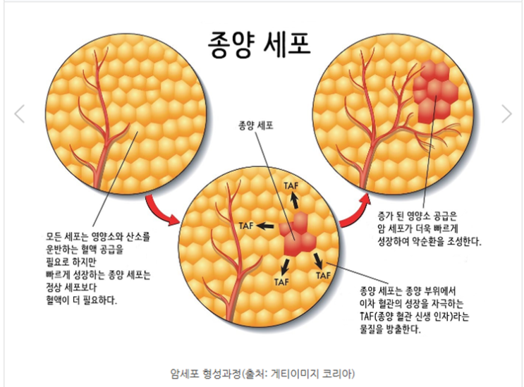 암진단비 보장범위 소액암 유사암과 함께 알아보기 네이버 블로그