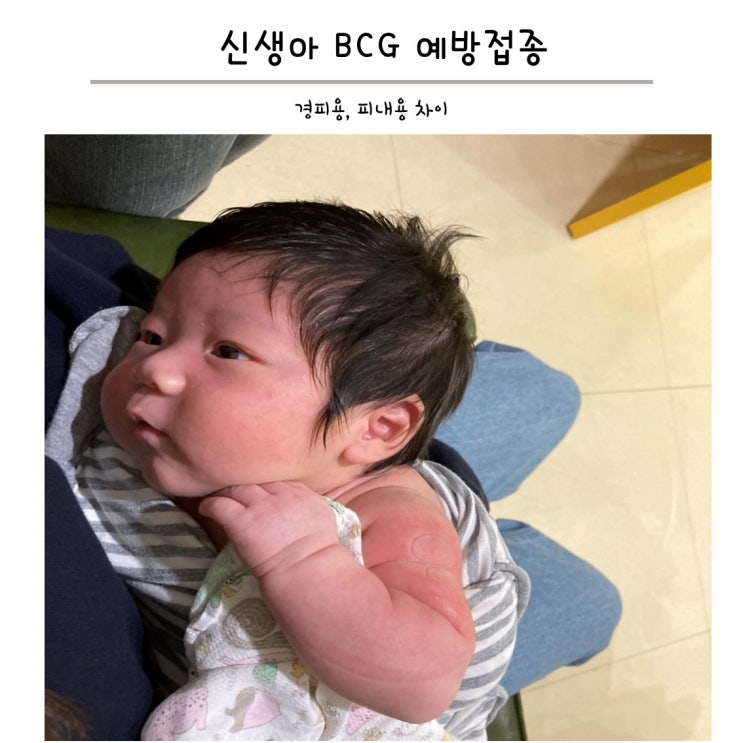 신생아 Bcg접종경피용피내용 차이 네이버 블로그