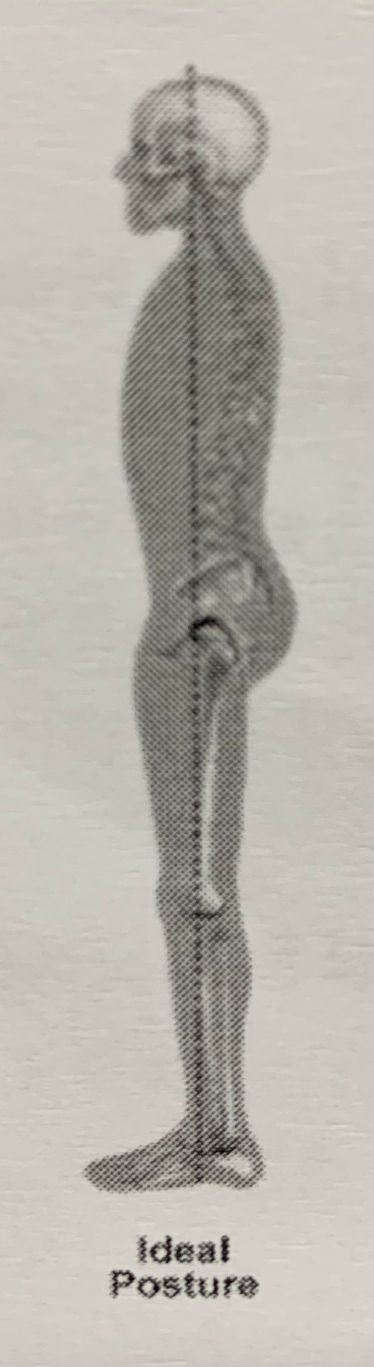 Kendal의 체형불균형-Kyphotic-Lordotic posture 울산피티 울산삼산피티 달동피티 신정동피티 옥동피티 ...