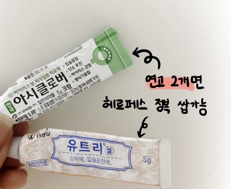 헤르페스 연고 추천 1n년 동안 고생한 사람의 자가치료법 네이버 블로그