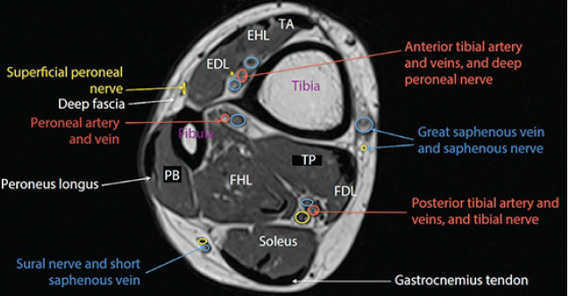 US anatomy of terminal nerves in the leg : 네이버 블로그