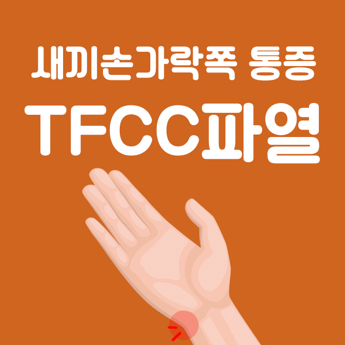 TFCC손상 진단과 증상! [가산정형외과] : 네이버 블로그