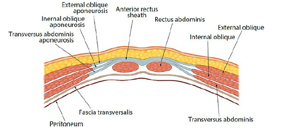 US guided rectus sheath block : 네이버 블로그