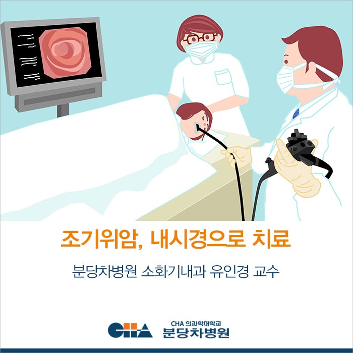 조기위암 내시경으로 치료 내시경 점막하 박리술분당 차병원 소화기내과 유인경 교수 네이버 블로그
