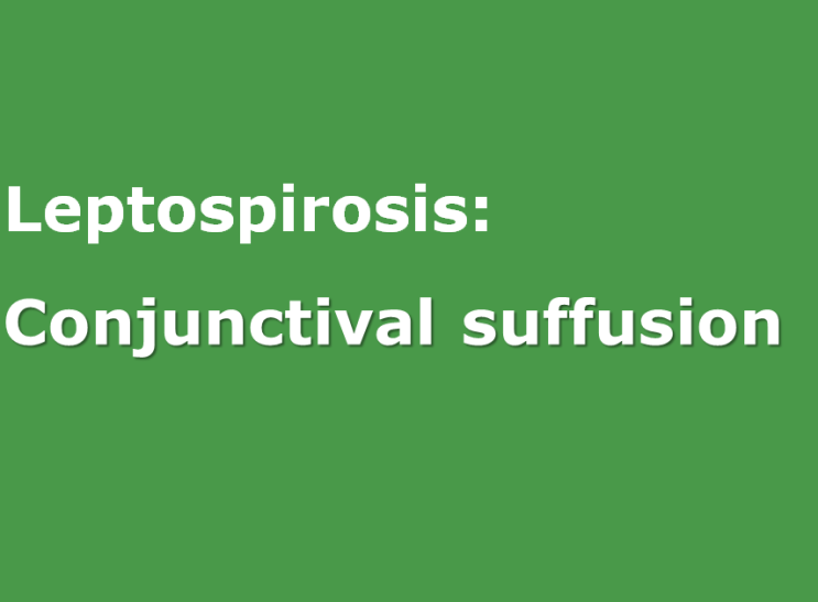 Leptospirosis : Conjunctival suffusion : 네이버 블로그
