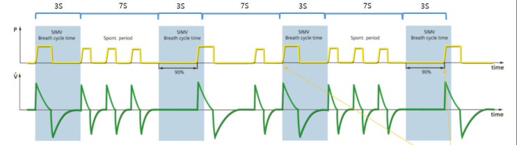 (Servo ventilator) SIMV 모드에서 강제호흡구간, breath cycle time, trigger window ...