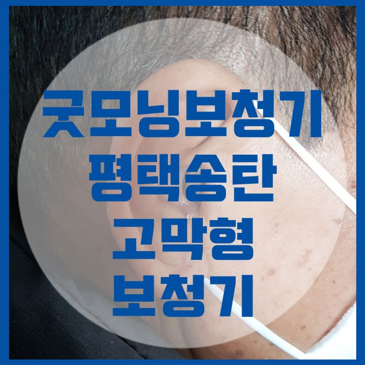 굿모닝보청기 평택송탄 80대 고객님 고막형 Cic 보청기 착용사례 네이버 블로그