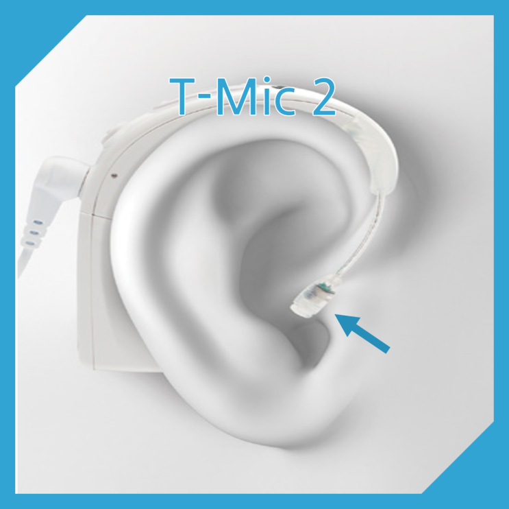 AB인공와우의 특허기술 T-Mic(마이크)2 소개 : 네이버 블로그