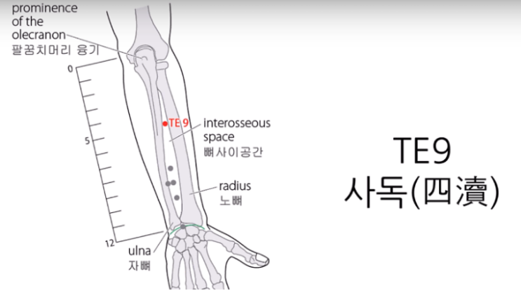 뉴혈처) 신간 코로나미스터리 , 삼양락(TE8) 사독(TE9) 위치 효능, 반하후박탕 임상활용 : 네이버 블로그
