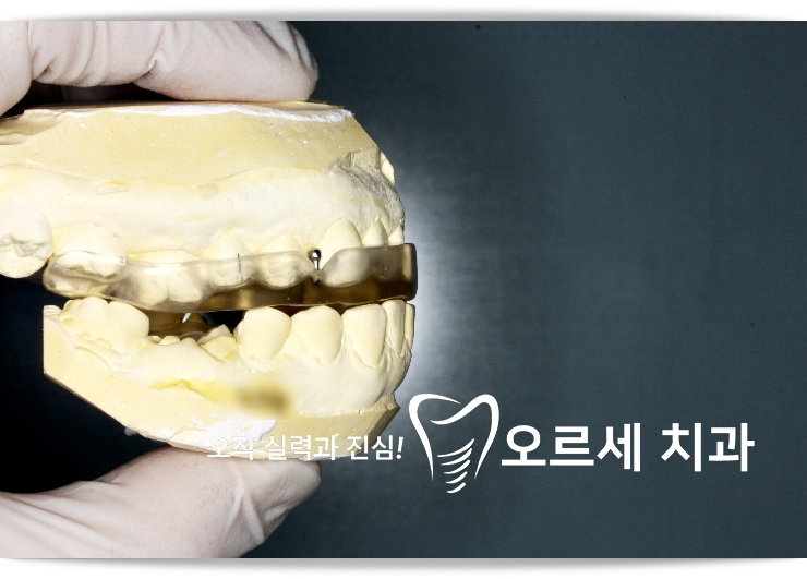 입이 잘 안벌어지는 턱관절질환 해결했어요 네이버 블로그