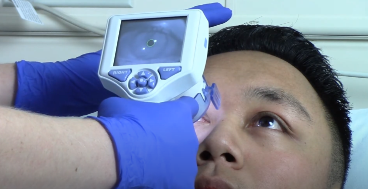 NPi-200 Pupillometer : 네이버 블로그