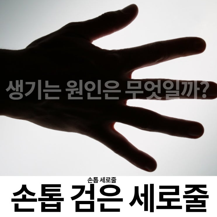 은평 응암 울퉁불퉁 검은 세로줄 손톱 손톱 흑색종 네이버 블로그