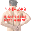 강서구 양천구 신경외과 강서나누리병원 허리디스크 척추관협착증 치료에는 척추내시경수술 네이버 블로그