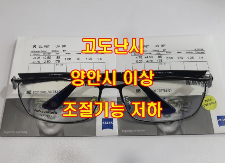 고등학생 눈 불편함의 원인 고도난시 양안시 이상 그리고 조절기능이상으로 집중력저하~부산 양안시 기능검사 전문안경원추천
