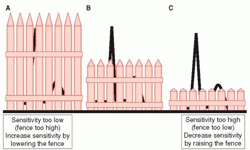 [Pace maker기본] output, sensitivity, threshold, capture, sensing 이해하기 ...