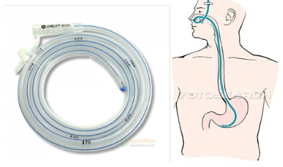 L-tube(levin tube) : 네이버 블로그