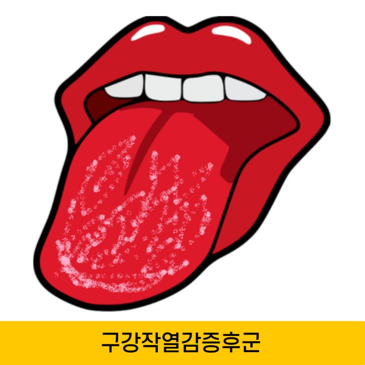 구강작열감증후군을 아시나요? : 네이버 블로그