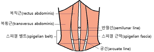 Carnett 징후(Carnett's sign) : 네이버 블로그