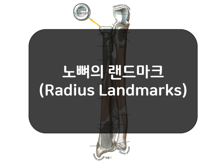노뼈의 랜드마크(Radius Landmarks)!! : 네이버 블로그
