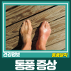 통풍 초기 증상 발 손가락 통증 체크 네이버 블로그