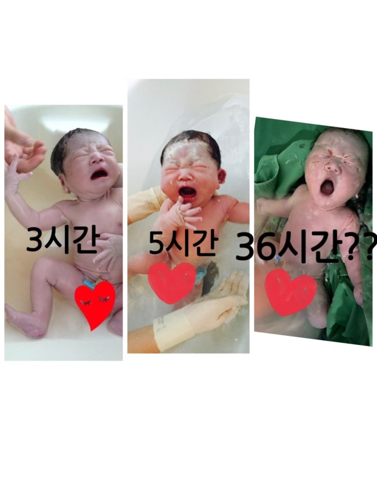셋째임신 38주 3일 36시간 진통한 출산후기 자연분만 유도분만 무통주사 네이버 블로그
