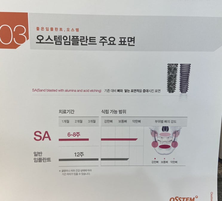 발치통증어금니발치하악어금니발치발치치과임플란트임플란트발치발치마취치아발치임플란트통증임플란트후기어금니마취발치통증
