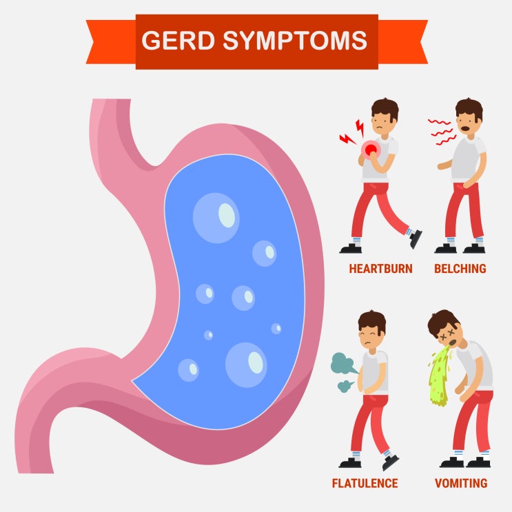 의학용어 GERD 질환 및 간호 : 네이버 블로그