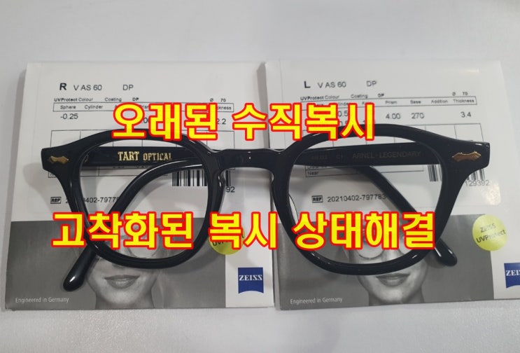 오래된 4번 신경이상으로 고개돌림과 고개 기울임 그리고 복시 증상을 호소하는 30대 초반의 남성의 복시해결안경부산 복시 해결