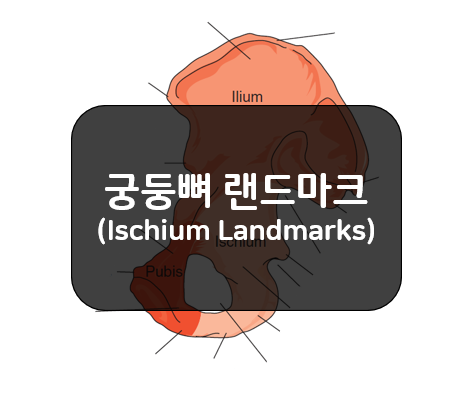 볼기뼈 랜드마크 1부(Innominate, Hip Bone Landmarks) - 궁둥뼈(Ischium) : 네이버 블로그
