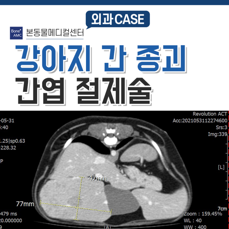 강아지 간에 커다란 종괴가 있어요 강아지 간 종괴 제거 수술 간엽절제술 네이버 블로그