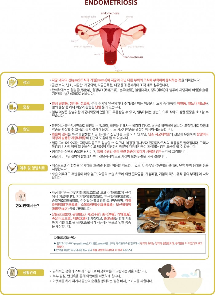 자궁내막증 자궁선근증 자궁근종 차이 비교 만성 골반통 생리통 성교통 배변통 혈뇨나 배뇨통 자궁근종 난임 근종