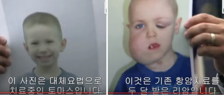 [5년 전 오늘] 암 산업(癌 産業)의 이면(裏面) - Cut Poison Burn : 네이버 블로그