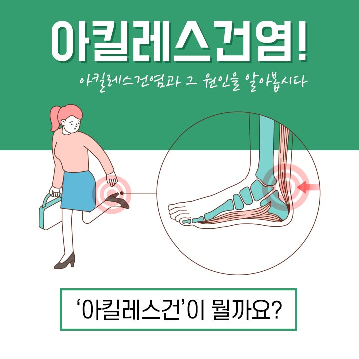 아킬레스건염 주의 발뒤꿈치 통증 유발하는 족부 질환 네이버 블로그