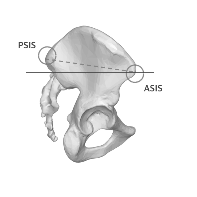 골반에 있는 ASIS 와 PSIS 라는 지점과 중립골반에 대해서 : 네이버 블로그