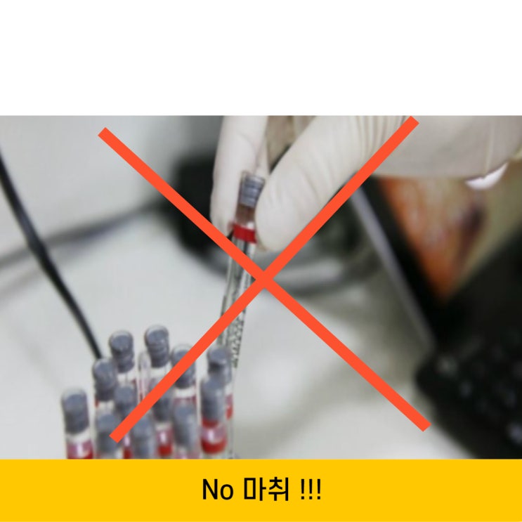 응암역치과 소아 실란트 치료를 아시나요? : 네이버 블로그