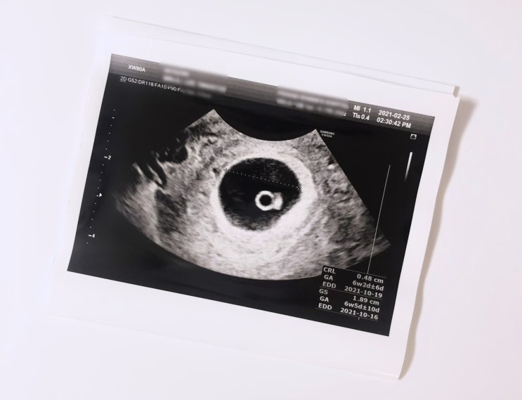 [6w5d] 안녕, 빠미야 :) : 네이버 블로그