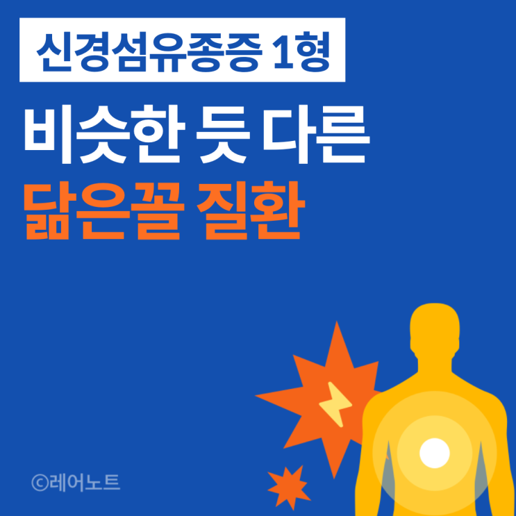 신경섬유종증 1형과 비슷한 듯 다른 왓슨 증후군, 누난 증후군 : 네이버 블로그