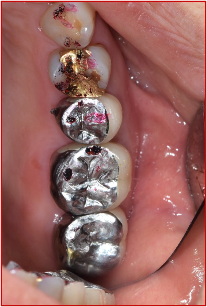 잘 안 씹혀요~~~ㅜㅜ : 네이버 블로그