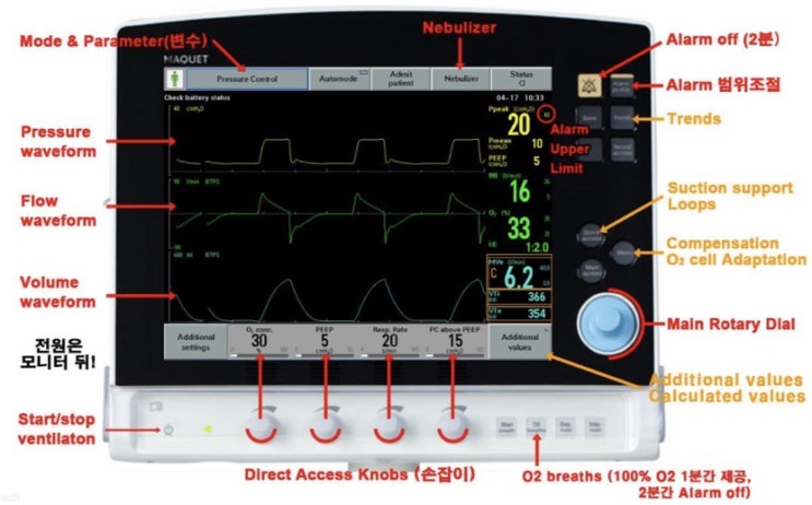Ventilator 알람, 용어, mode, PBW (servo-i, servo-air) : 네이버 블로그