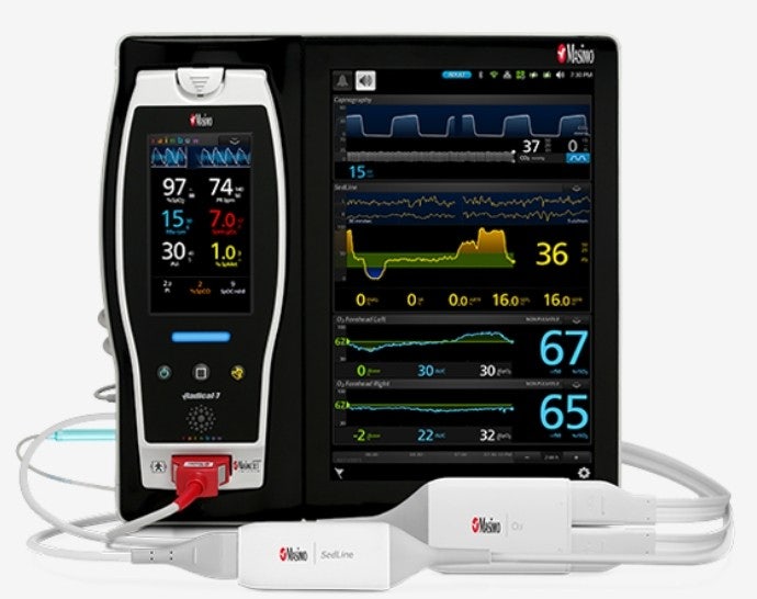 PSI (patient state index) 와 rSO2 (regional so2) 의 정의와 정상수치 : 네이버 블로그
