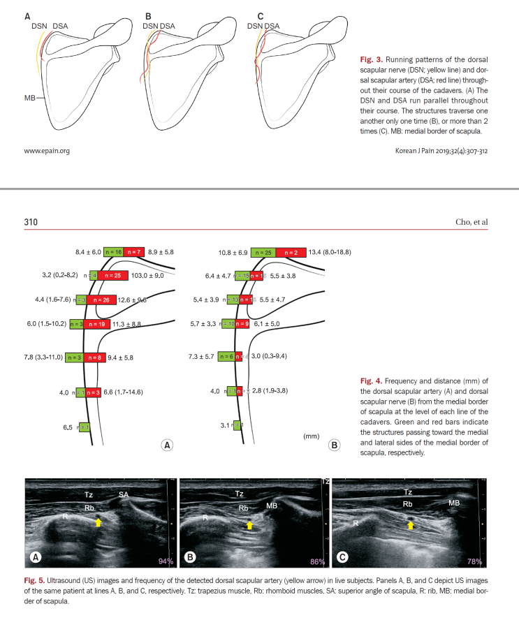 DSNB(dorsal scapular nerve block) : 네이버 블로그