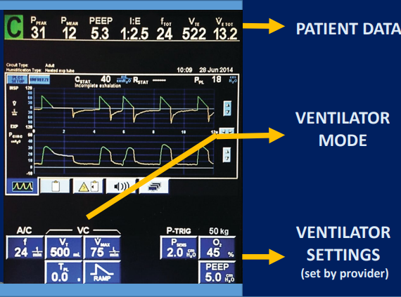 PB ventilator (PB 840, SST test방법, PAV mode) : 네이버 블로그