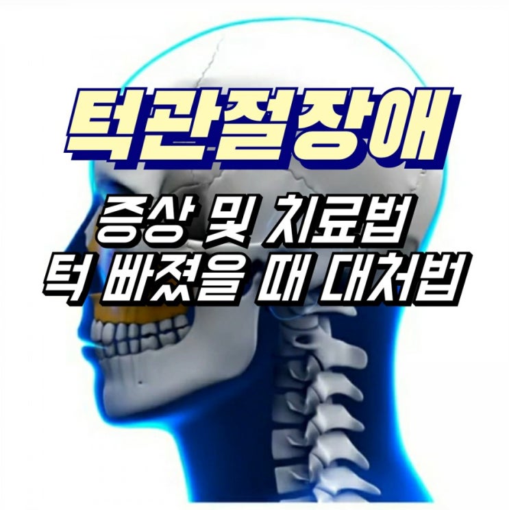 턱관절장애 증상 및 치료법 통증 턱소리 턱디스크 턱 빠졌을 때 대처방법 턱빠짐 네이버 블로그